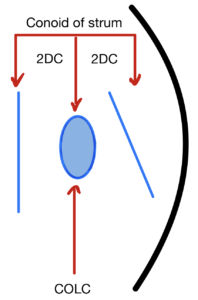 Jackson Cross Cylinder - OptomInSight