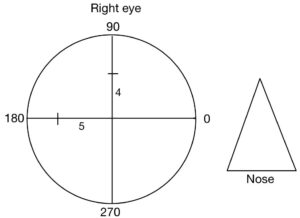 Compounding and resolving prism - OptomInSight