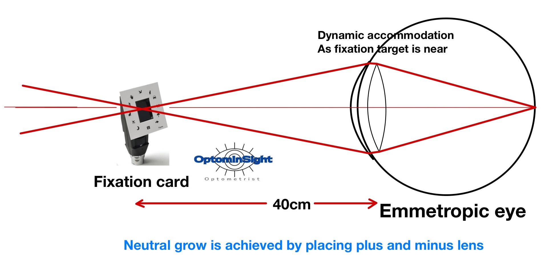 Monocular estimation method - OptomInSight Monocular estimation method - OptomInSight