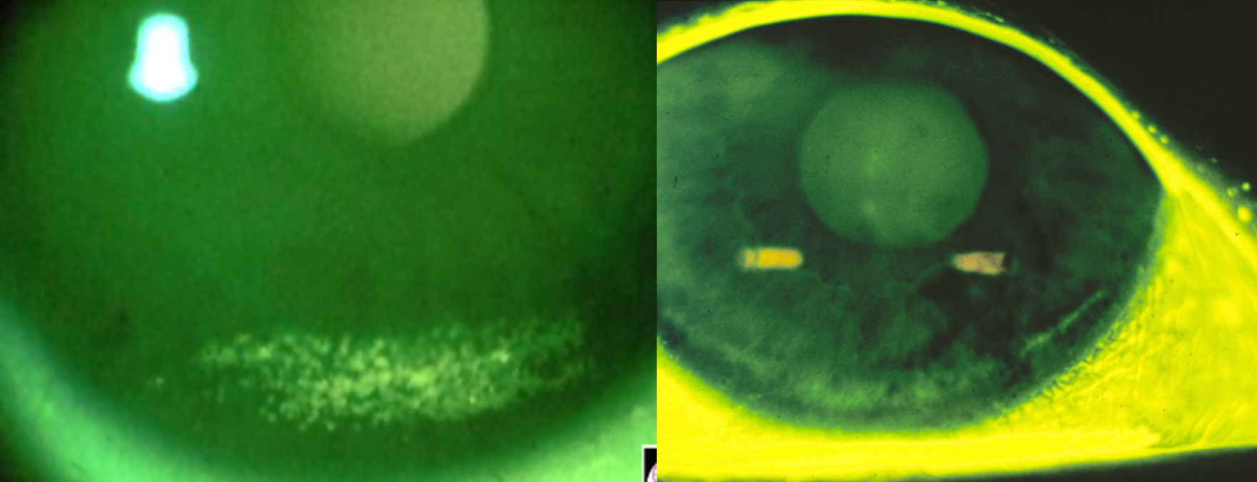 OPTOMETRY PICTURE QUIZ